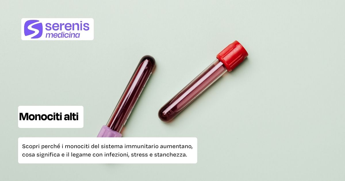 Monociti alti: cosa significano, cause e quando preoccuparsi